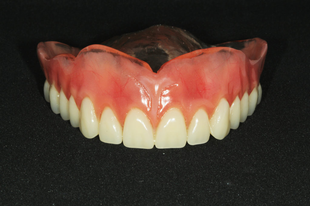 Próteses dentárias - Dra. Maria Cecilia Giacomel